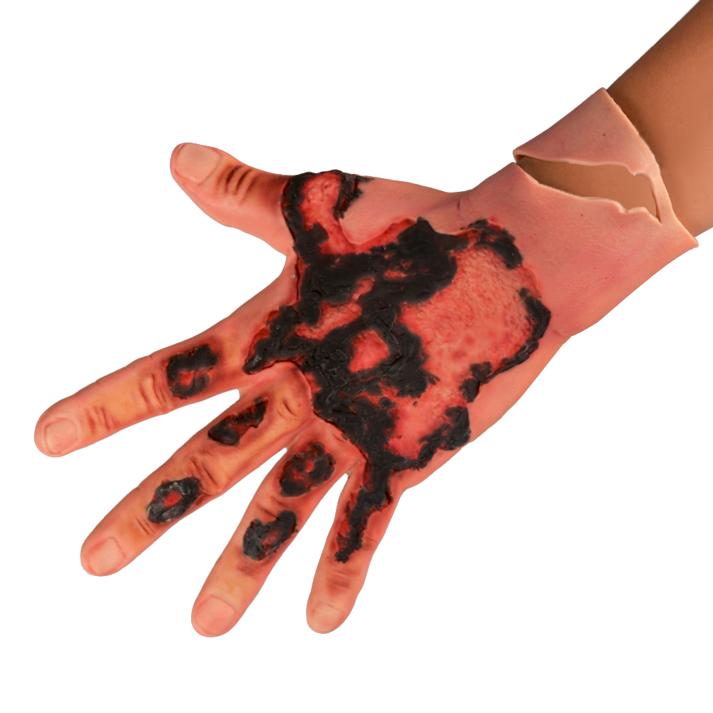 Wearable Burn Wound Hand Simulator