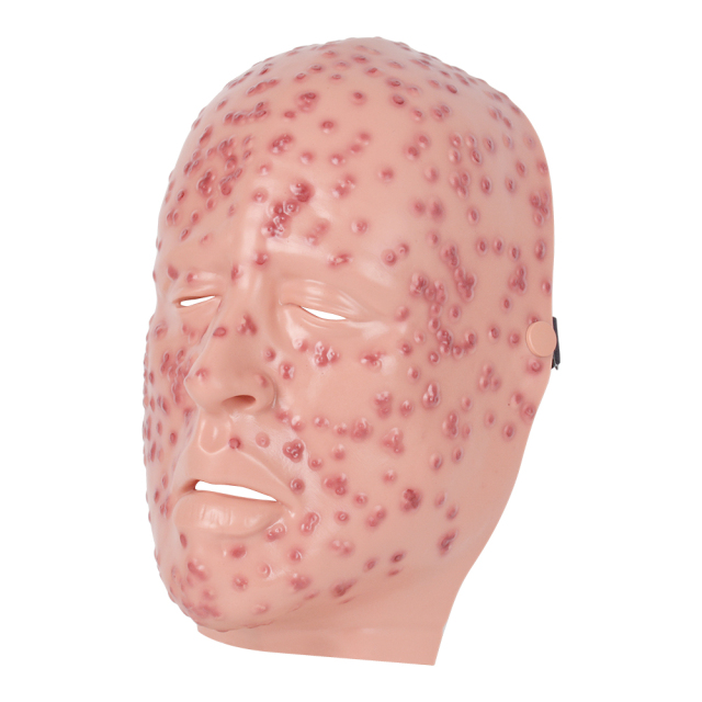 Severe Smallpox Face Training Simulator