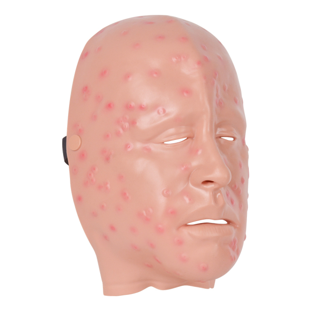 Mild Smallpox Facial Lesion Training Mask