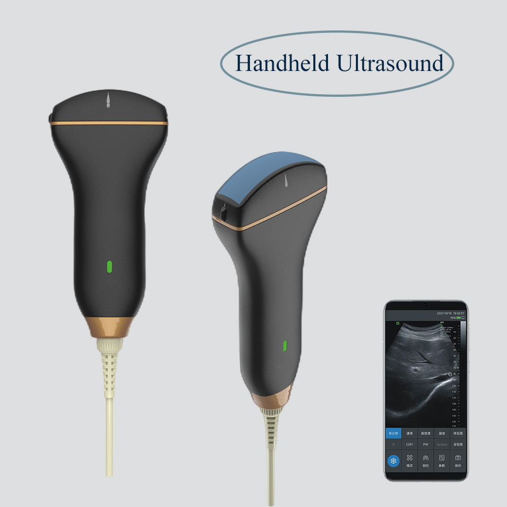 color Doppler USB convex probe scanner