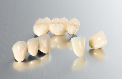 Porcelain Fused to Metal (PFM) Bridge Crown Wholesale Supplier