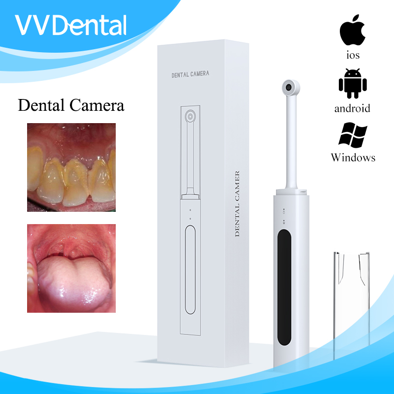 Intraoral Dental Scanner Intraoral Camera Intra Oral Camera Dentistry ...