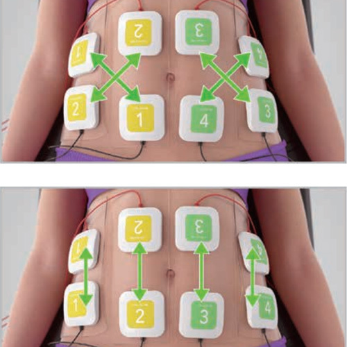 electrostimulation muscle