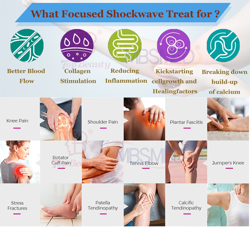 Portable Focused Shockwave Therapy Machine for Pain Management & ED ...