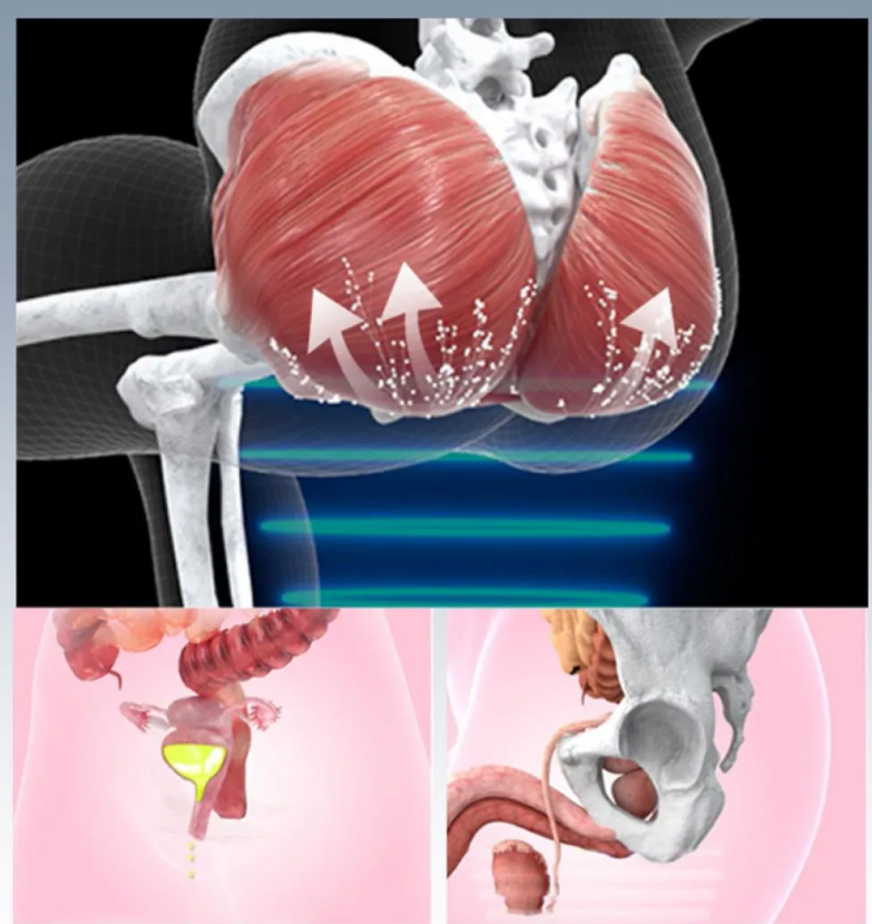 EMS Pelvic Floor Chair Cushion Kegel Machine for Postpartum Incontinence