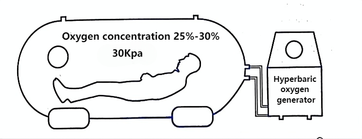 How Much is a Hyperbaric Chamber? Price Ranges & Buying Guide
