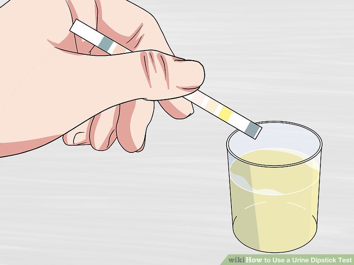 How To Use A Urine Dipstick Test how-to-use-a-urine-dipstick-test